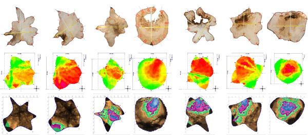 Accuracy and reproducibility of acoustic tomography significantly ...